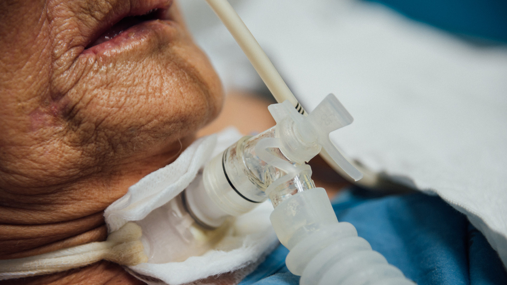Enhancing Trach Care - Compass Complex Discharge Solutions